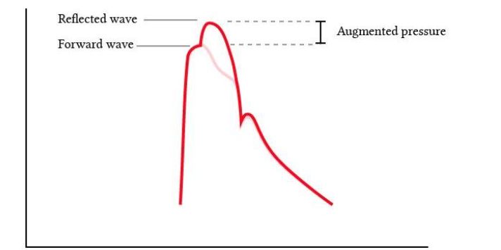 AI-Enhanced Non-Invasive Blood Pressure Waveform Analysis - European ...