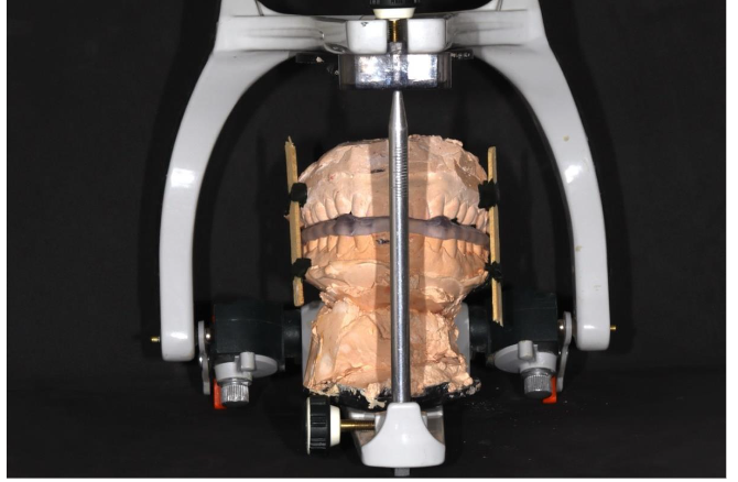 Bradasch Technique for Mandibular Position in TMD Patients - European ...