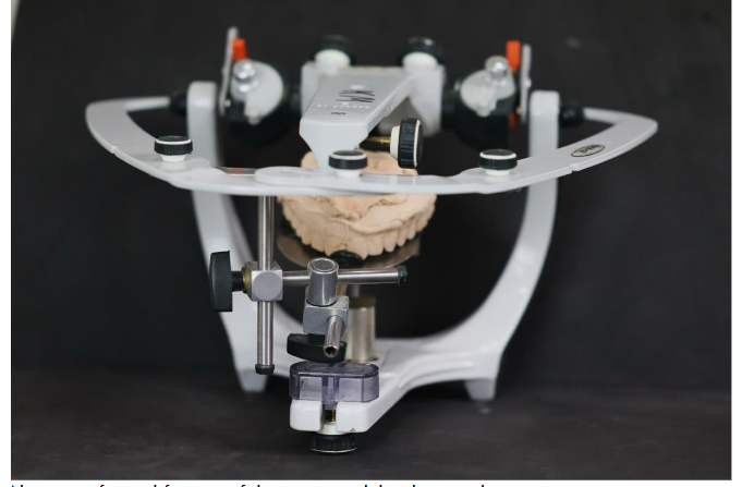Bradasch Technique for Mandibular Position in TMD Patients - European ...