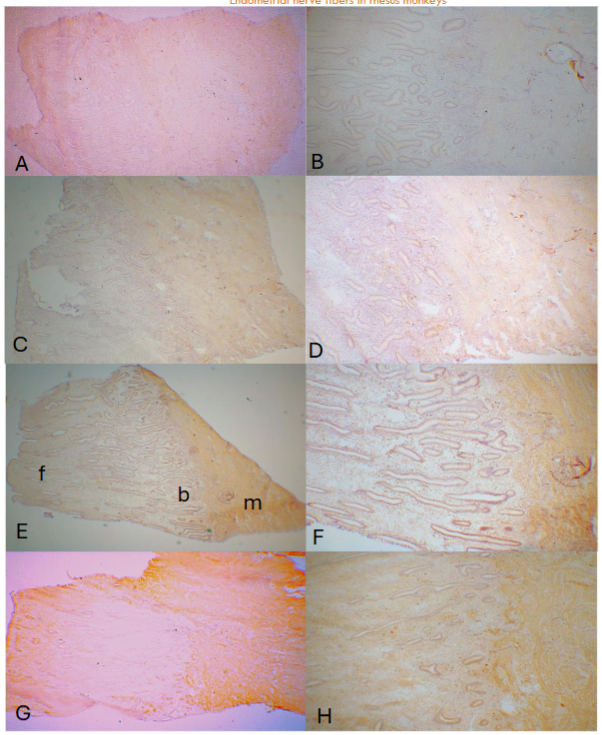 Endometrial Nerve Fibers in Rhesus Monkeys Study - European Society of ...