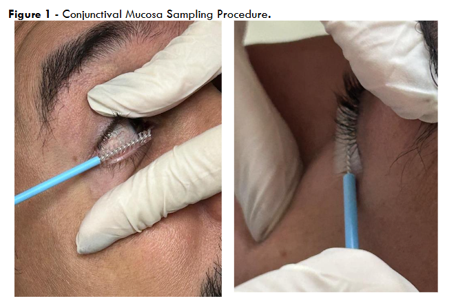 Genotoxic Assessment of Conjunctival Mucosa Samples - European Society ...