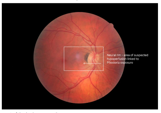 Health Effects of Water-Damaged Buildings: A Review - European Society ...