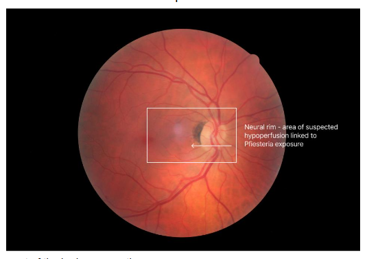 Human Health Effects of Water-Damaged Buildings: A Review - European ...