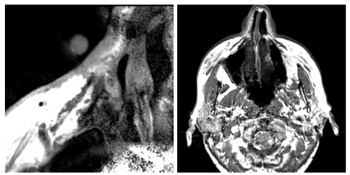 Imaging Skin Lesions: CT, MRI, Ultrasound, and PET Insights - European ...