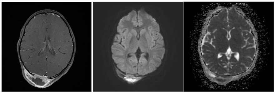 Imaging Skin Lesions: CT, MRI, Ultrasound, and PET Insights - European ...