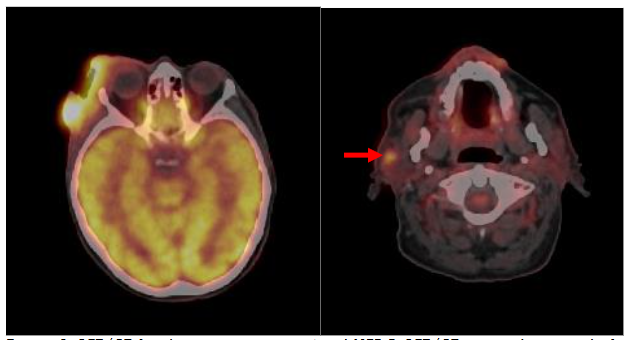Imaging Skin Lesions: CT, MRI, Ultrasound, and PET Insights - European ...