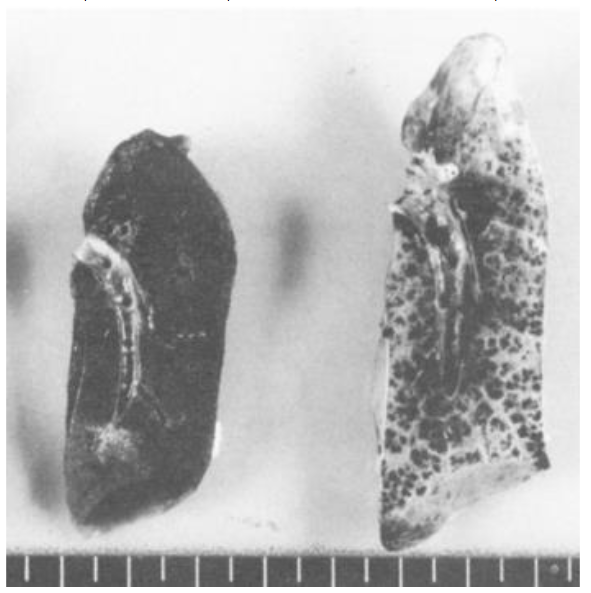 Impact of Biomass Smoke on Pneumonia Morbidity in Japan - European ...