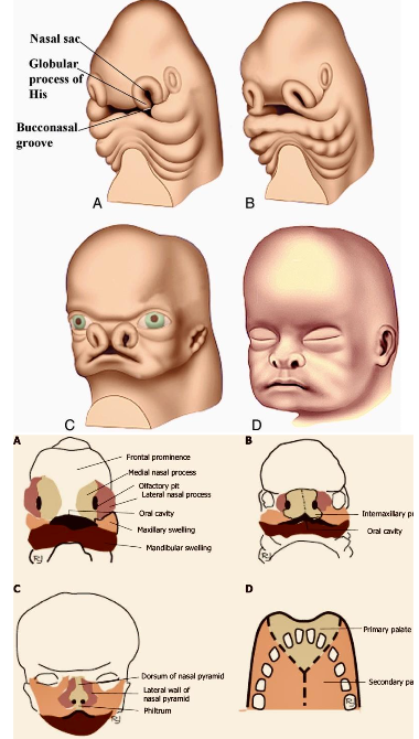 Maxillofacial Abnormal Bone Fusion: Surgical Insights - European ...