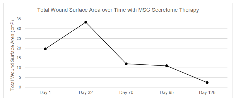 Mesenchymal Stem Cell Secretome for Chronic Wound Healing - European ...