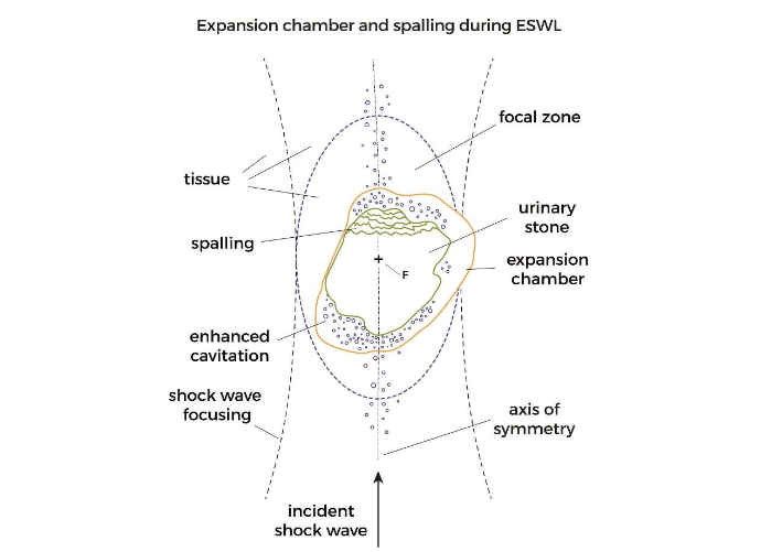 Misconceptions in Shock Wave Medical Therapy Explained - European ...
