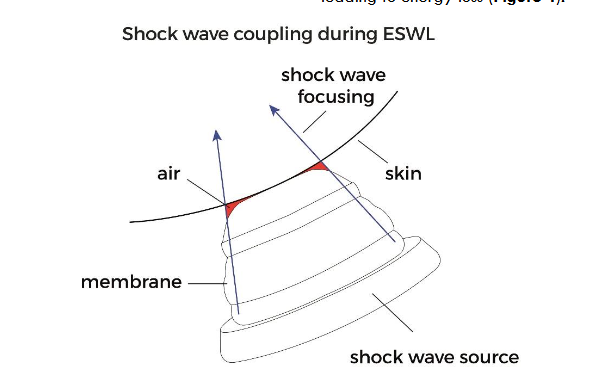 Misconceptions in Shock Wave Medical Therapy Explained - European ...