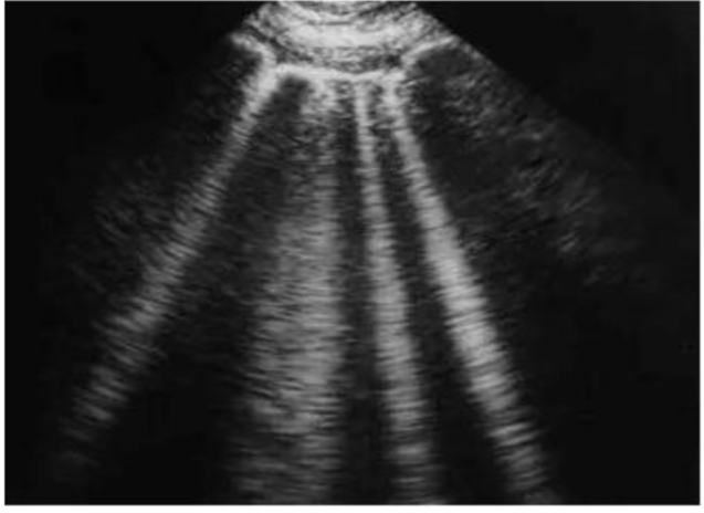 Preoperative POCUS in Hip and Femur Fracture Patients - European ...