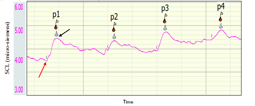 Sympathetic Response to Self-Observed Balance Loss - European Society ...