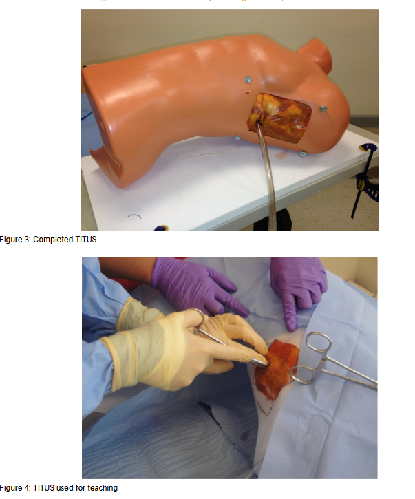 Affordable Chest Tube Training Simulator for EM Residents - European ...